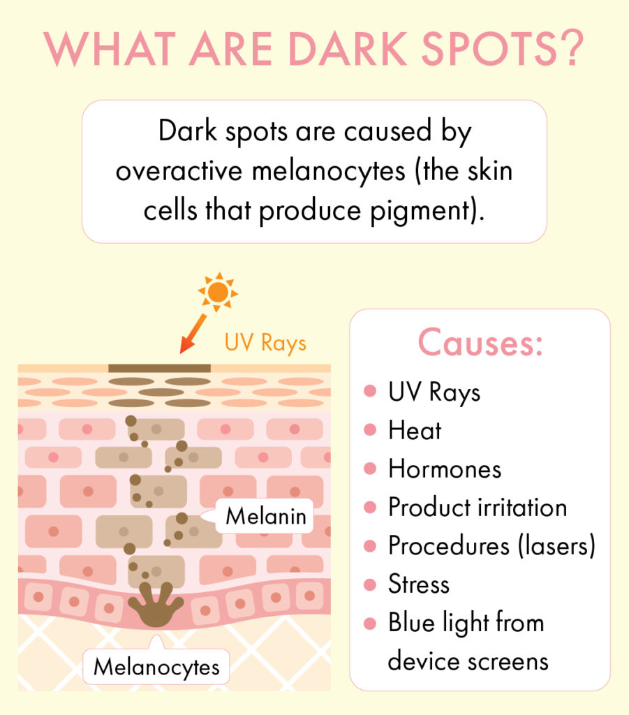 How To Treat Dark Spots Like A Derm | Blog | HUDA BEAUTY