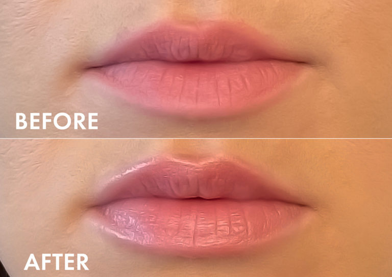 #HBTries: Can This TikTok-Trending Lip Plumper Replace Lip Fillers ...